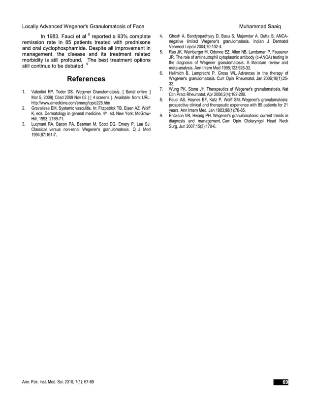 Wegeners granulomatosis of Face | PDF