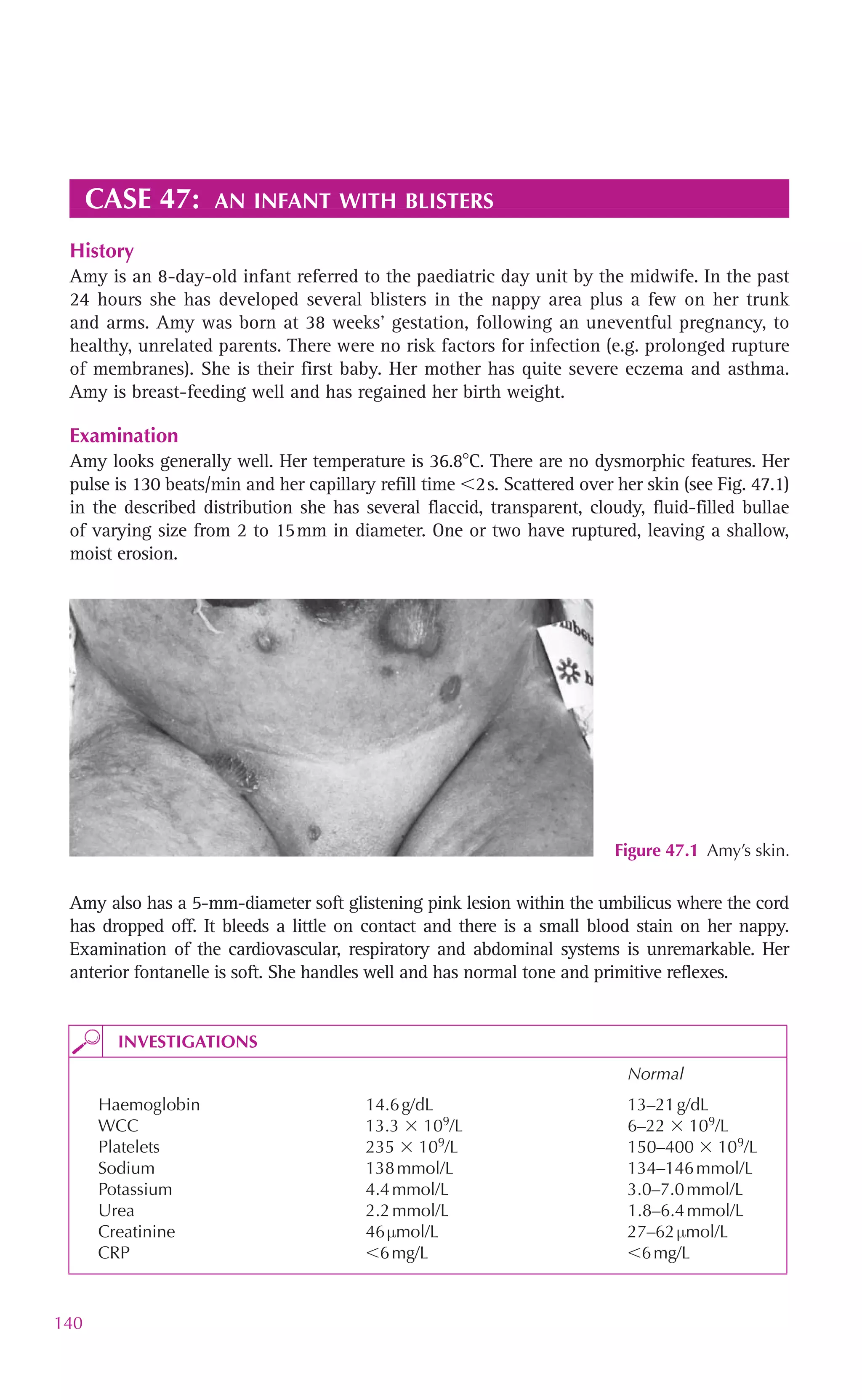100 cases-in-paediatrics.....dr .Ahmed Abdallah | PDF