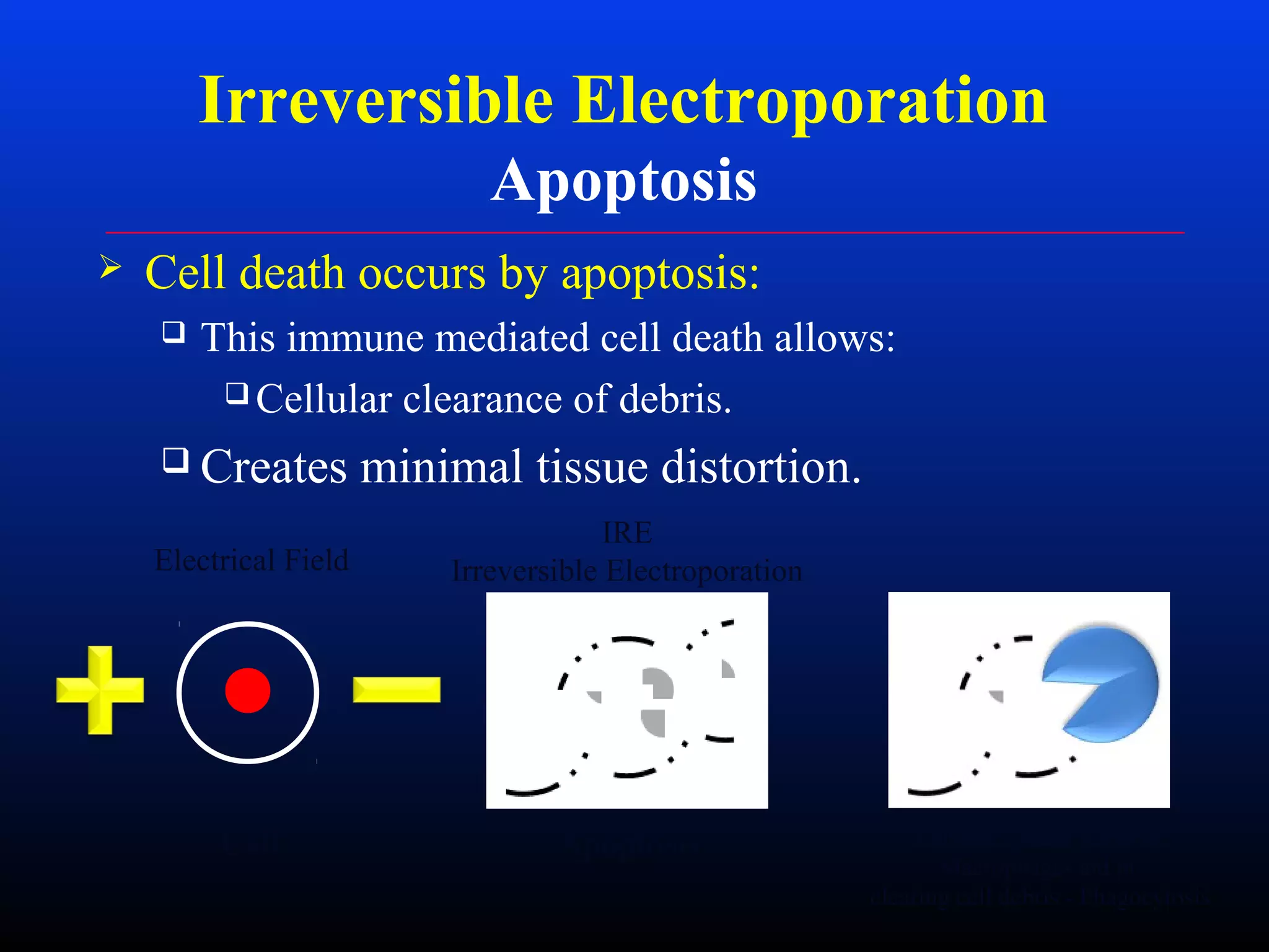 Ablation of HCC | PPT