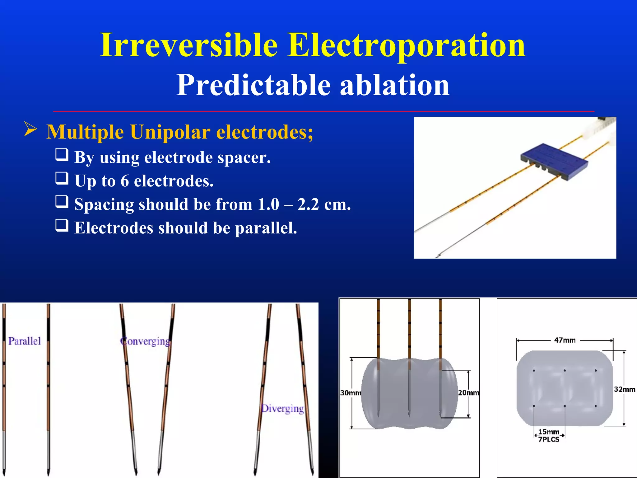 Ablation of HCC | PPT