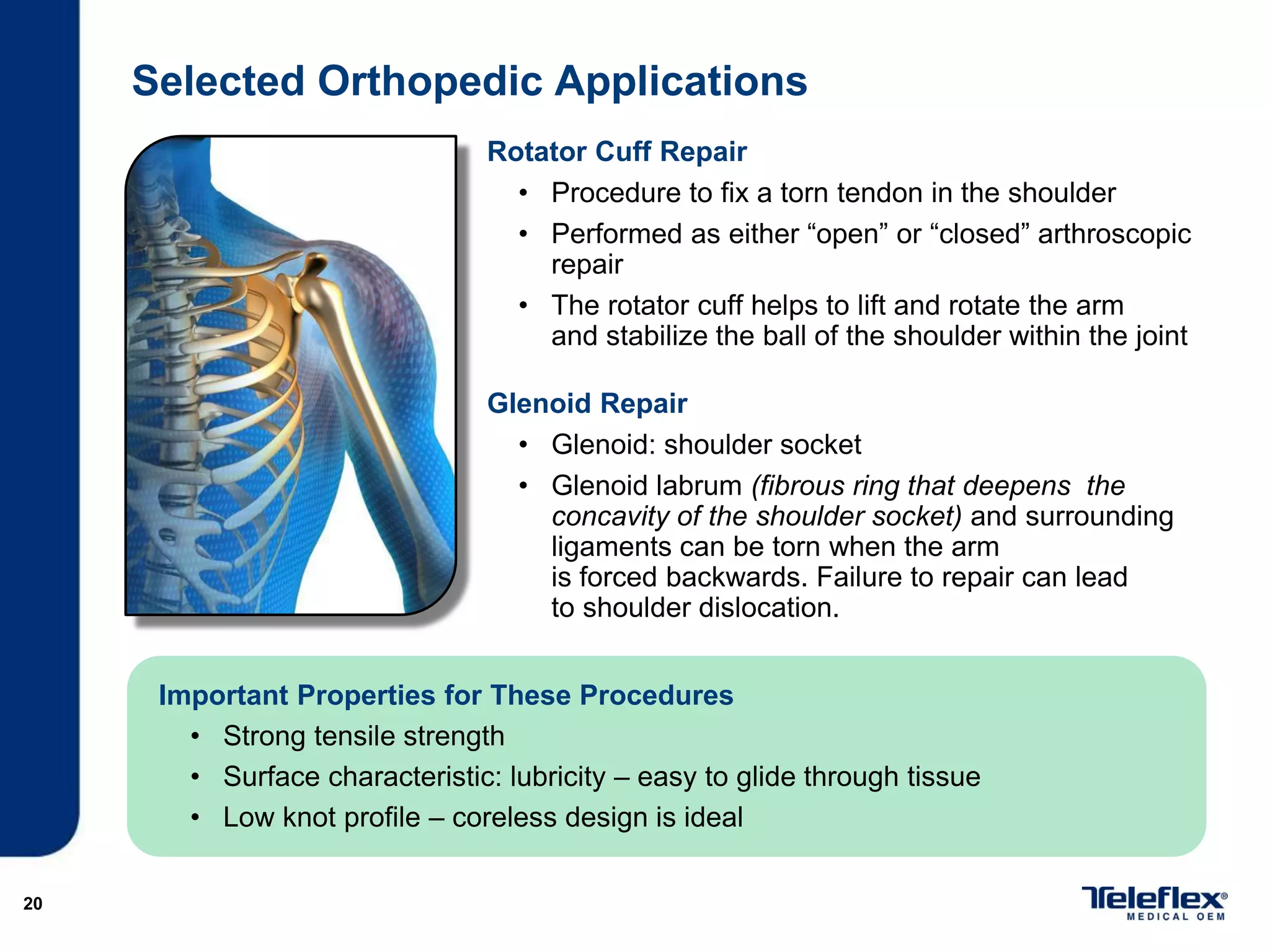Suture and Fiber Material Selections for Cardiovascular Device ...