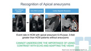 1005 Desai - Hypertrophic Cardiomyopathy Update.pdf