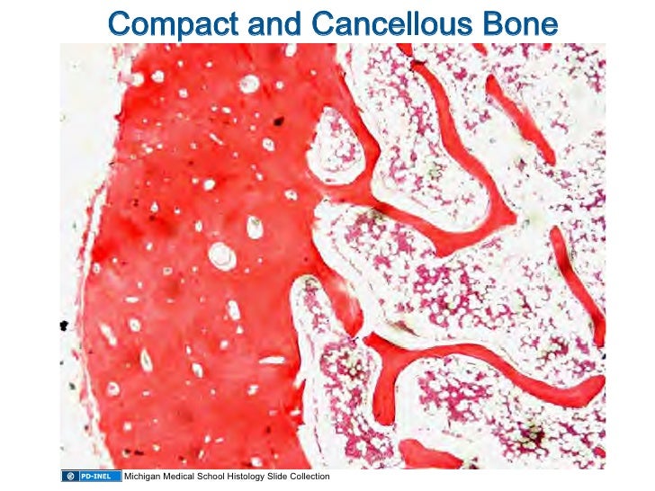 Spongy Vs Compact Bone Histology Bone Tissue Ch 6 Histology Of Bone