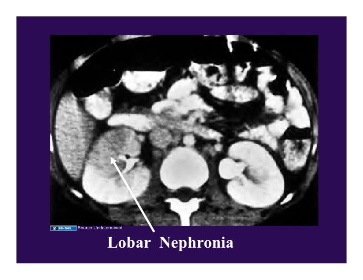 10.08.08: Diseases of the Kidney Upper Urinary Tract