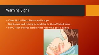 Heat Related Illnesses | PPTX