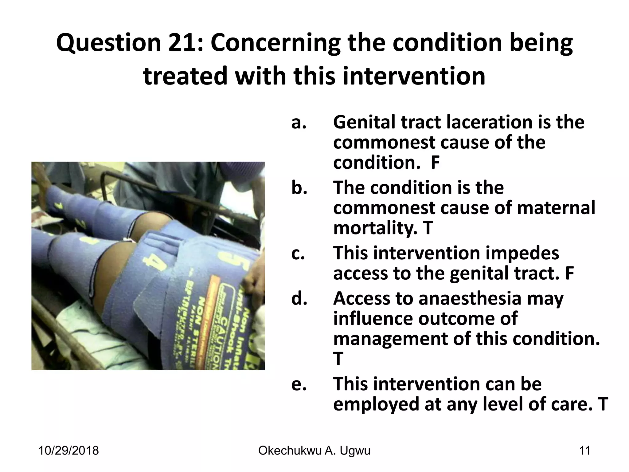 100 picture osce in obstetrics and gynaecology | PPTX