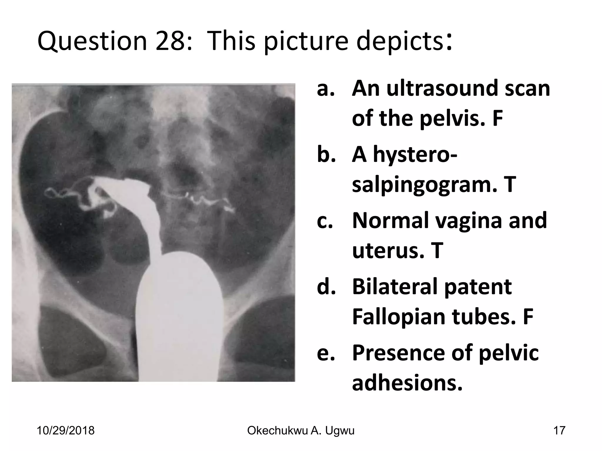 100 picture osce in obstetrics and gynaecology | PPTX