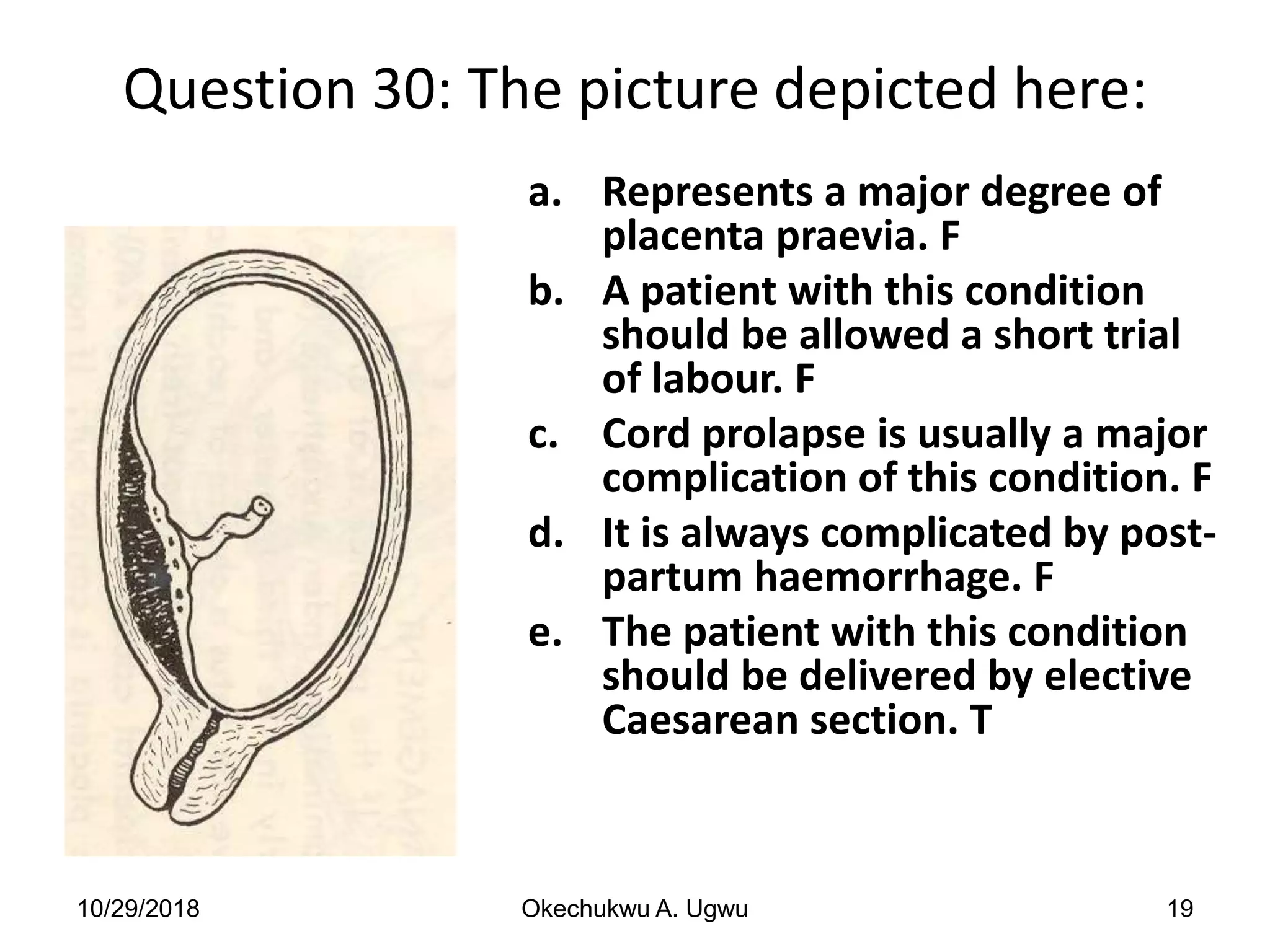 100 picture osce in obstetrics and gynaecology | PPTX