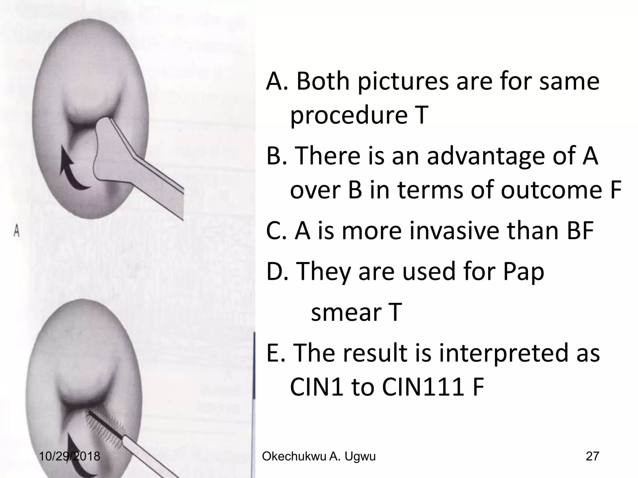 100 picture osce in obstetrics and gynaecology | PPTX