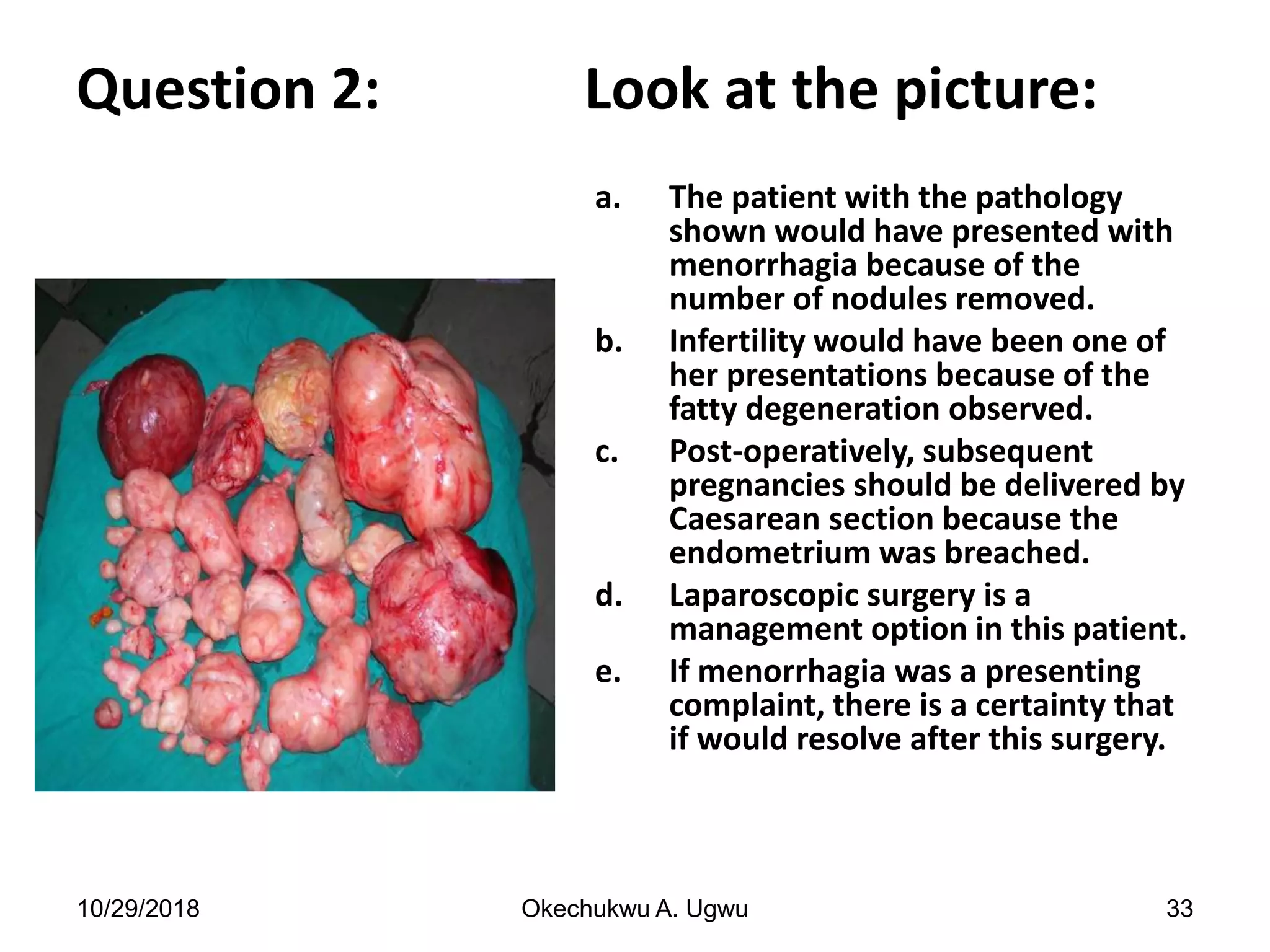100 picture osce in obstetrics and gynaecology | PPTX
