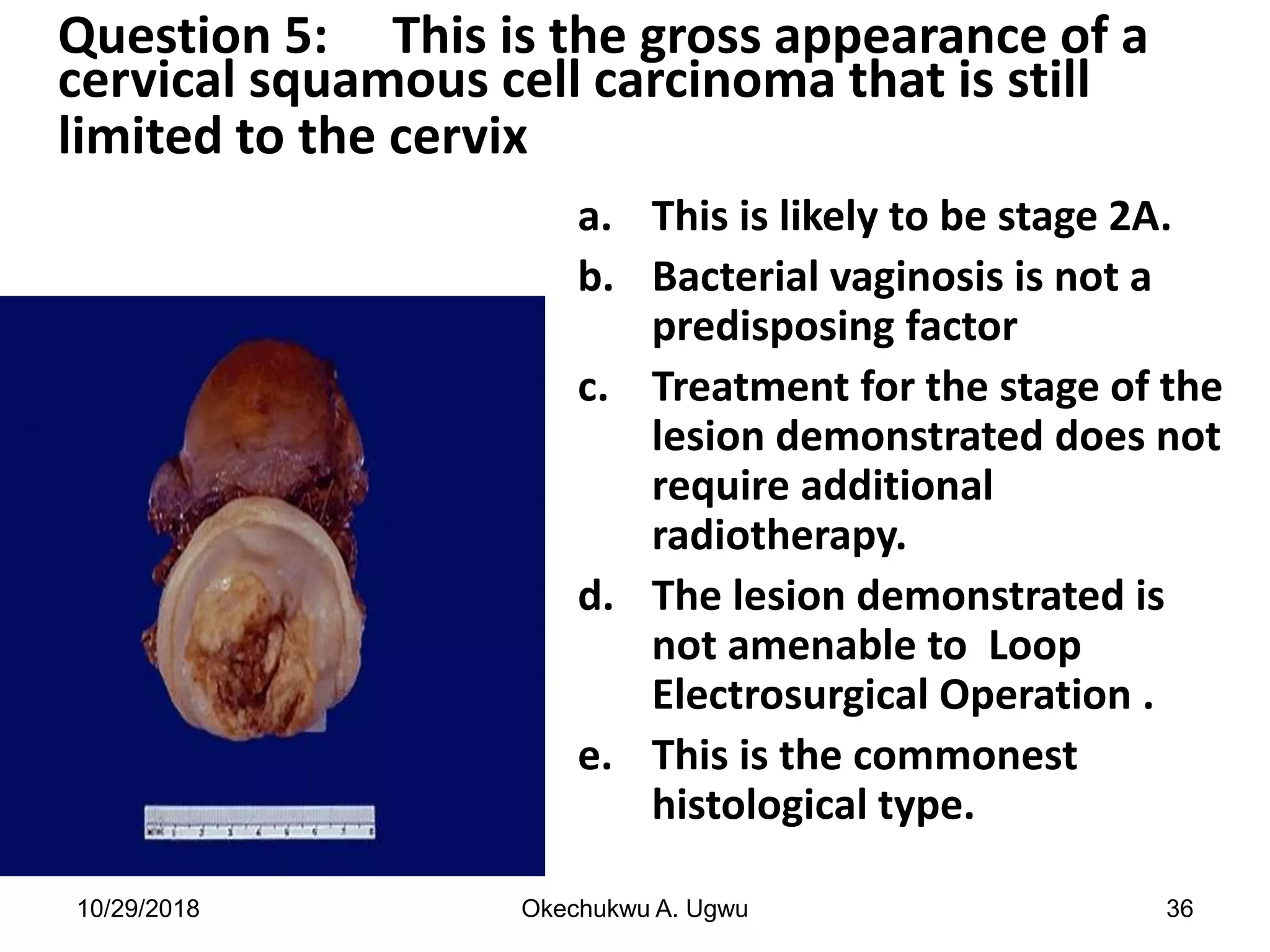 100 picture osce in obstetrics and gynaecology | PPTX