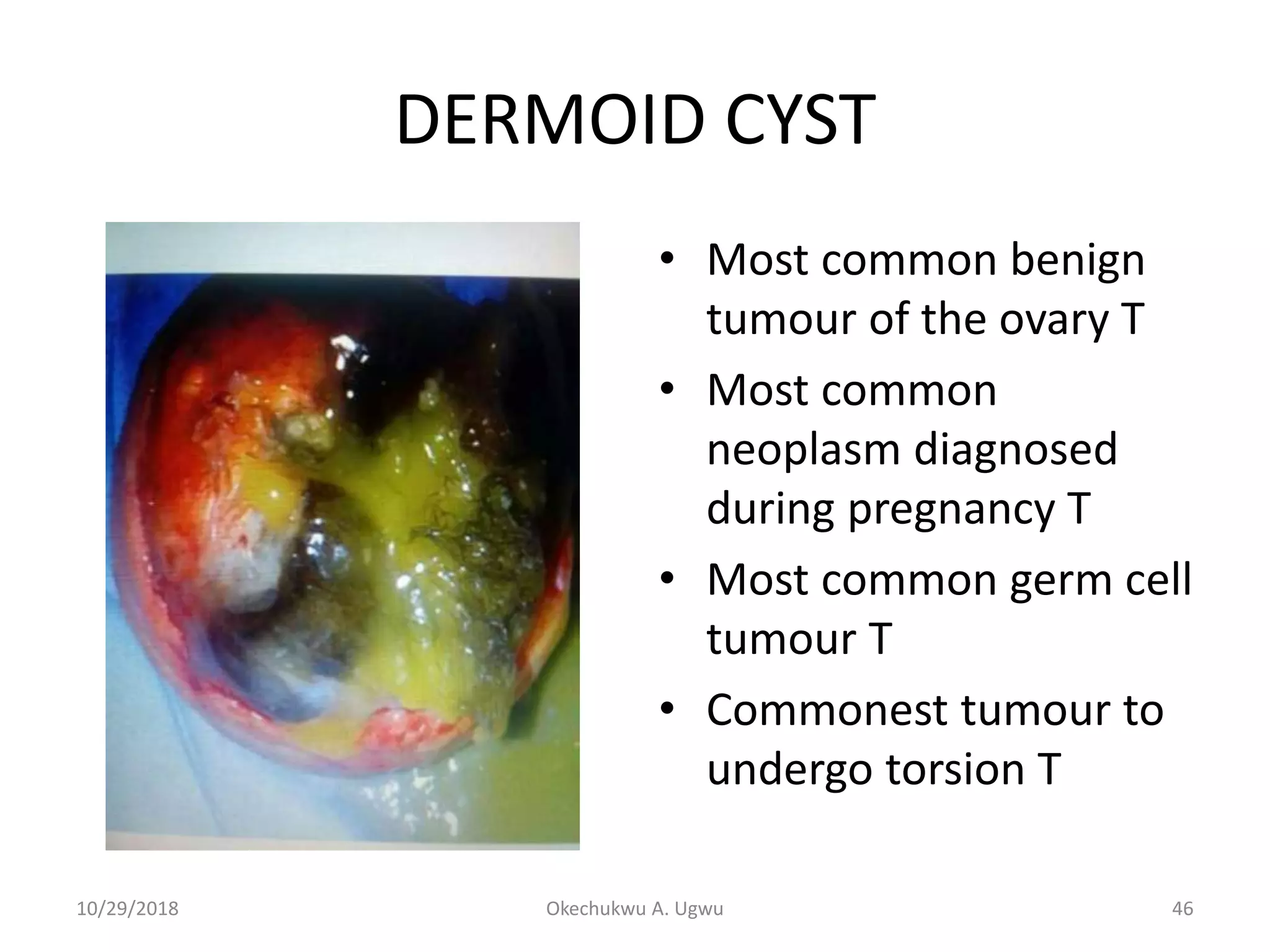 100 picture osce in obstetrics and gynaecology | PPTX