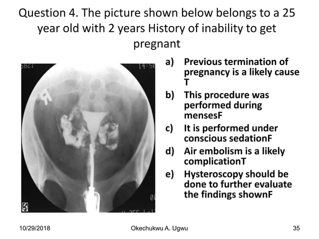 100 picture osce in obstetrics and gynaecology | PPTX | Birth Control ...