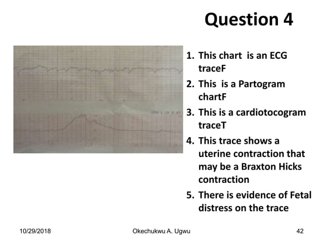 100 picture osce in obstetrics and gynaecology | PPTX | Birth Control ...