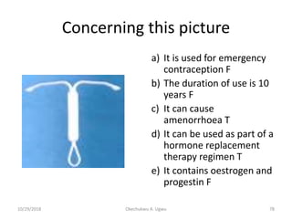100 picture osce in obstetrics and gynaecology | PPTX