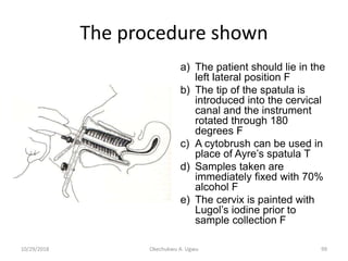 100 picture osce in obstetrics and gynaecology | PPTX