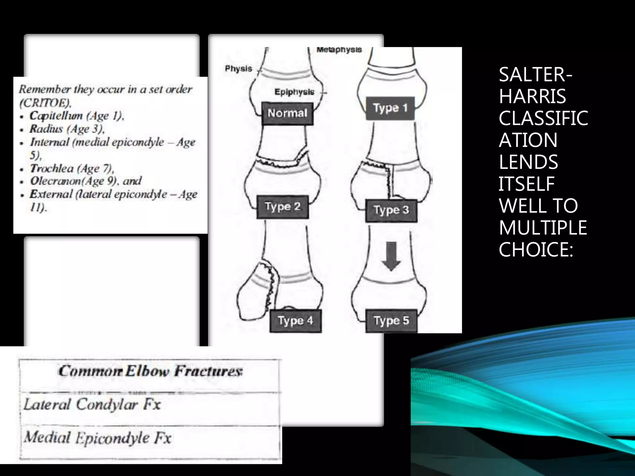 100 slides before EDiR exam | PPTX
