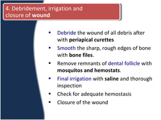 Complicated Extraction and Odontectomy | PPT