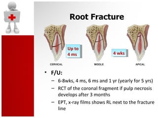 Traumatic Dental Injury and Treatment | PPT