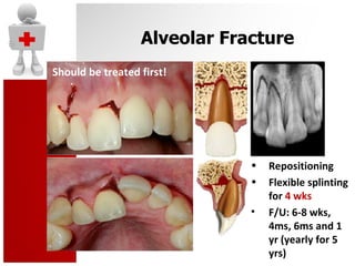 Traumatic Dental Injury and Treatment | PPT