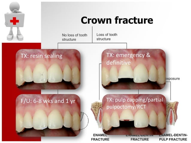 Traumatic Dental Injury and Treatment | PPT | Death, Injury, or ...