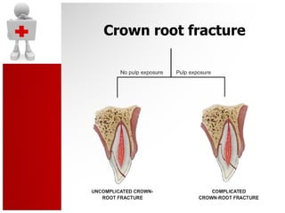Traumatic Dental Injury and Treatment | PPT