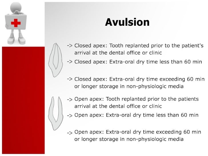 Traumatic Dental Injury and Treatment