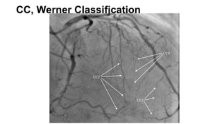 Sudhir Rathore: What is an interventional collateral? | PPTX | Heart ...