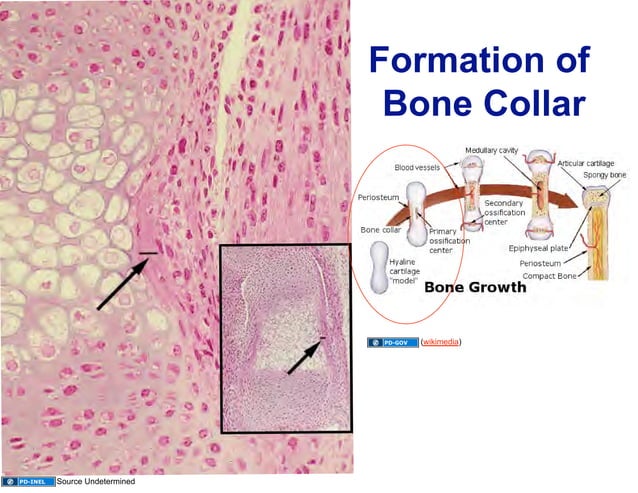 10.13.08: Histology - Bone Formation and Remodeling | PDF | Bone and ...