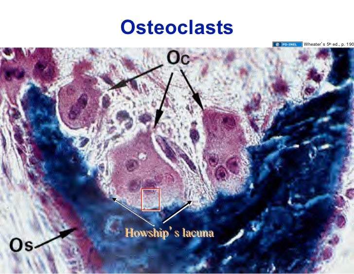 10.13.08: Histology - Bone Formation and Remodeling