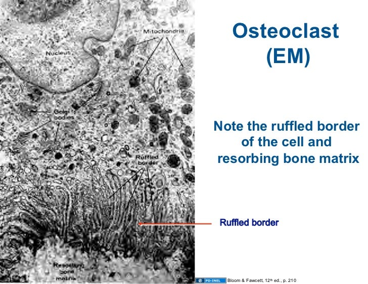 10.13.08: Histology - Bone Formation and Remodeling