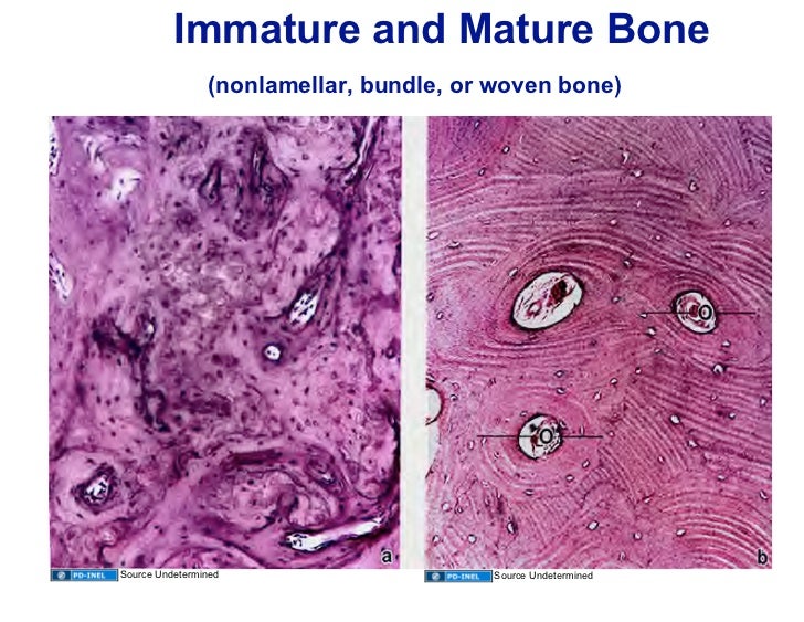 10.13.08: Histology - Bone Formation and Remodeling