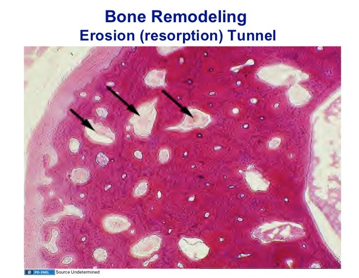 10.13.08: Histology - Bone Formation and Remodeling