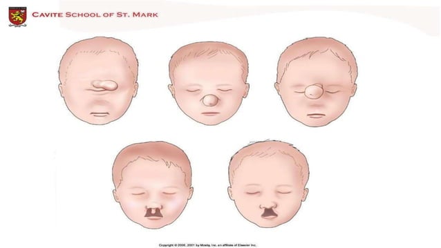 Genetic Disorders due to Error in Meiosis | PPTX
