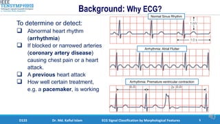 TENSYMP presentation | PDF