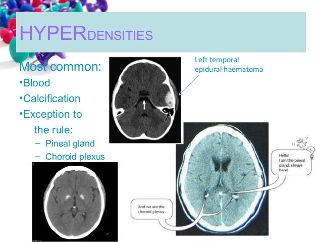 101 ct neuroimaging