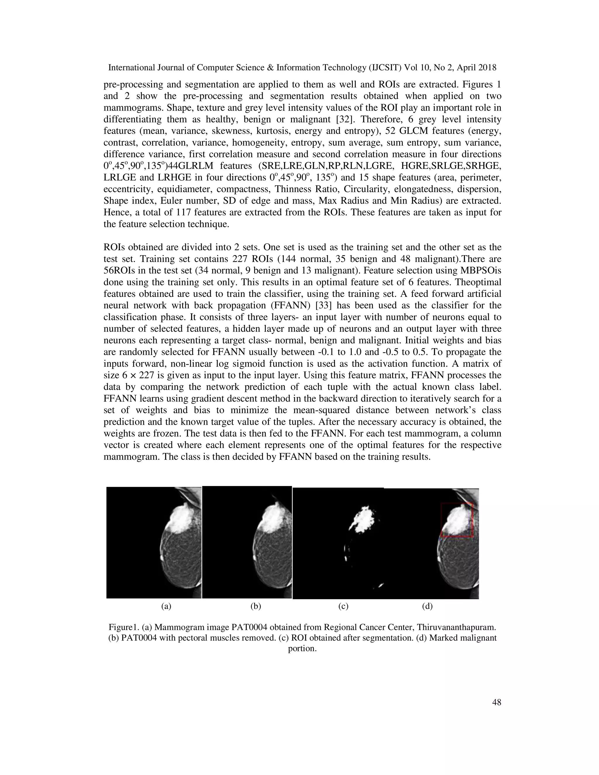 A MODIFIED BINARY PSO BASED FEATURE SELECTION FOR AUTOMATIC LESION DETECTION IN MAMMOGRAMS | PDF