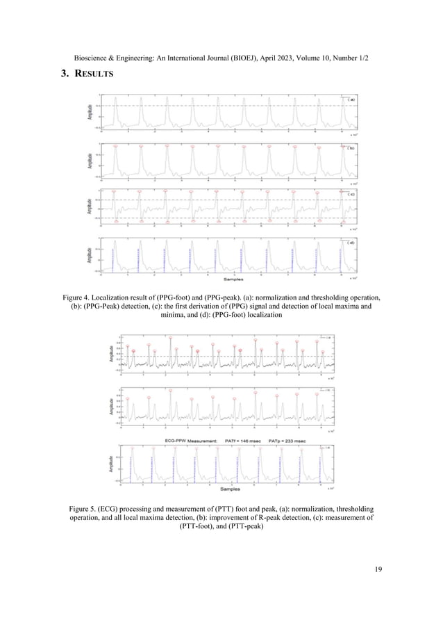A NEW LOW-COMPLEXITY ALGORITHM FOR THE PULSE TRANSIT TIME EVALUATION | PDF