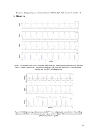 A NEW LOW-COMPLEXITY ALGORITHM FOR THE PULSE TRANSIT TIME EVALUATION | PDF