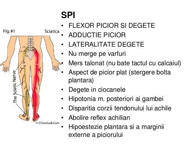 102373017 neurologie-kinetoterapie