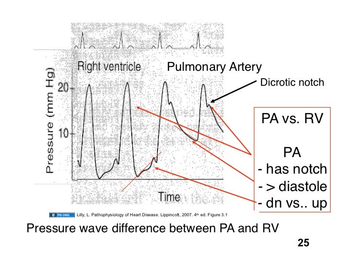 10.29.08(a): Cardiac Hydraulics