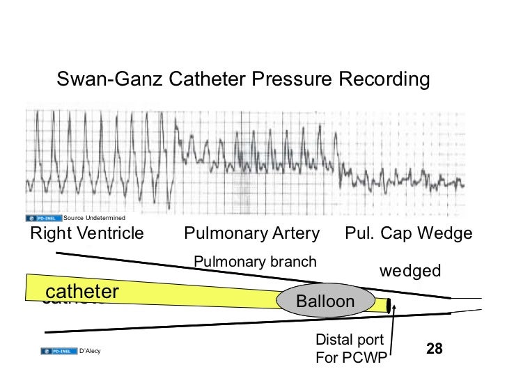 10.29.08(a): Cardiac Hydraulics