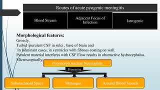Meningitis | PPT