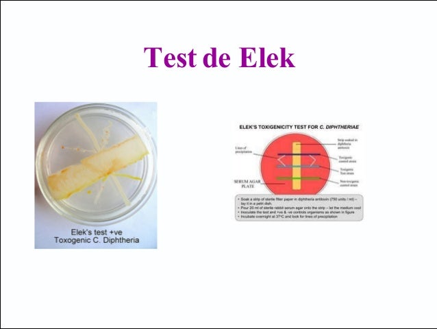 103. pw corynebacterium-2016_uc