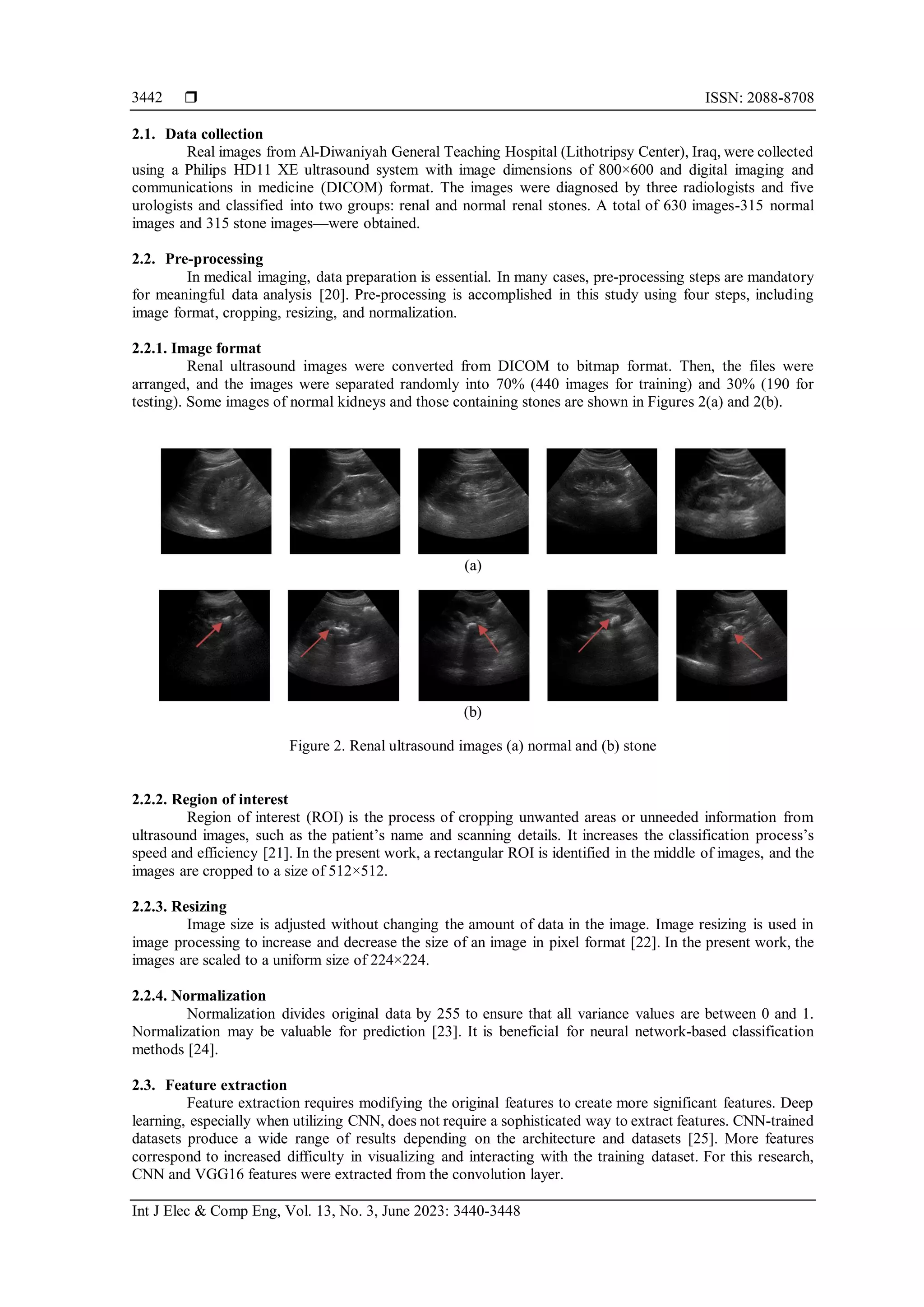 Ultrasound renal stone diagnosis based on convolutional neural network and VGG16 features | PDF