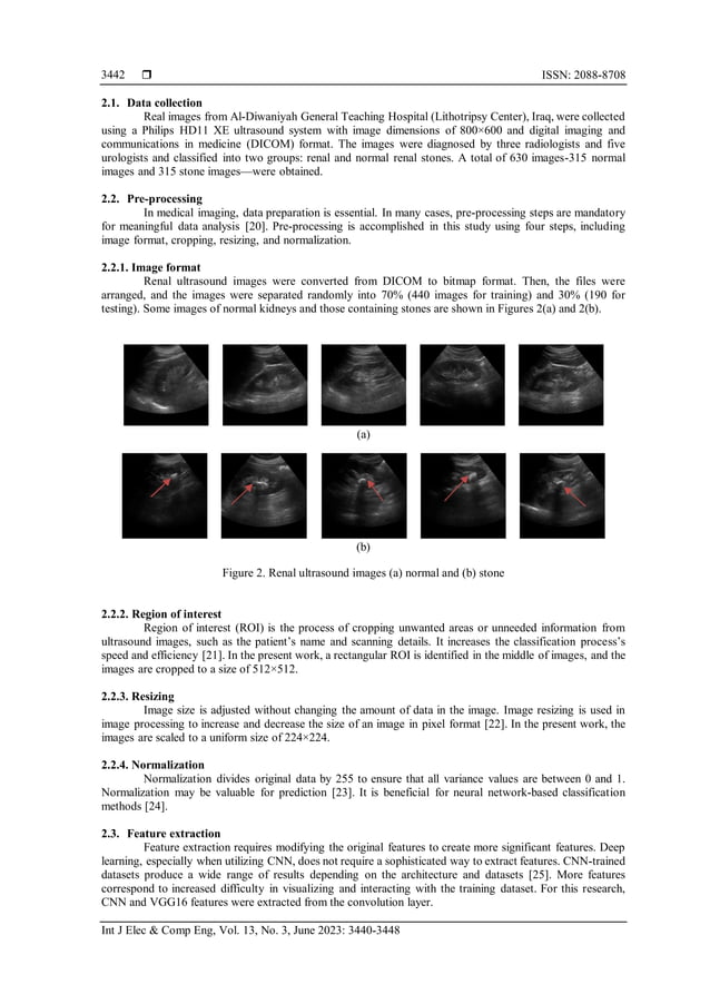 Ultrasound renal stone diagnosis based on convolutional neural network and VGG16 features | PDF