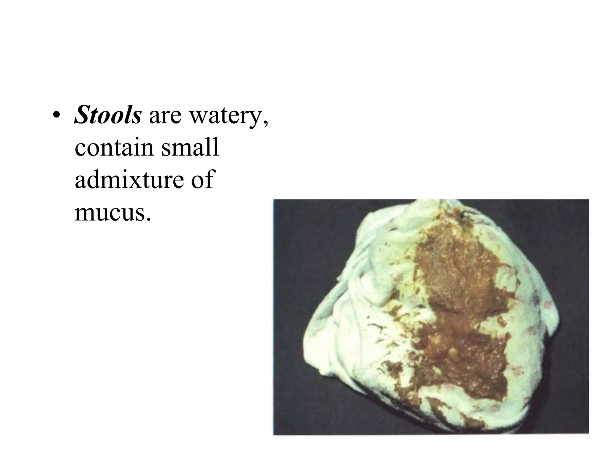 Acute intestinal infections | PPT