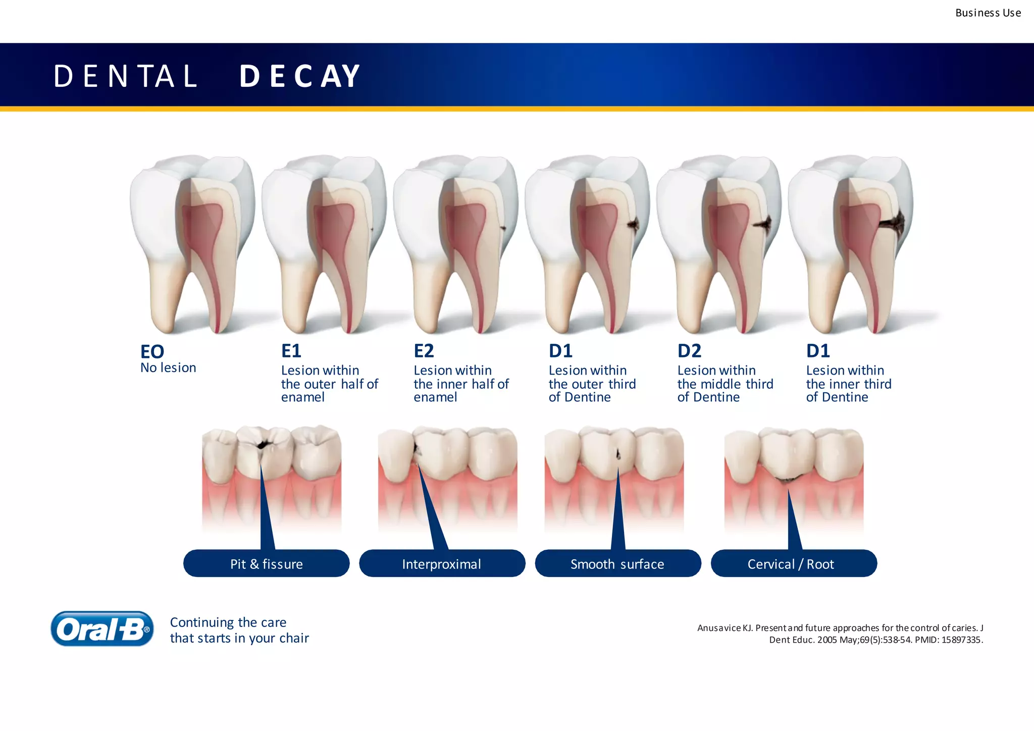 OralB_Patient_Guide_Flipchart final.pdf