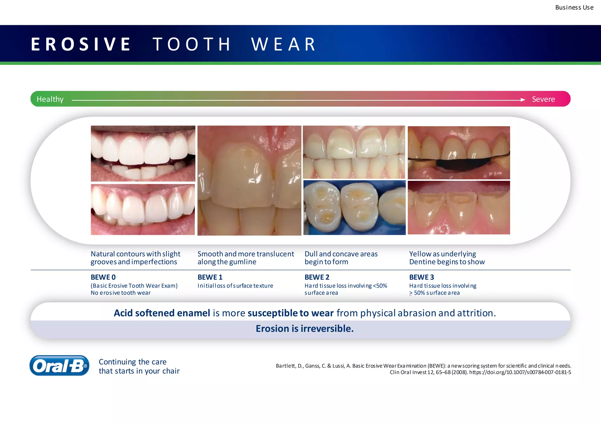 OralB_Patient_Guide_Flipchart final.pdf