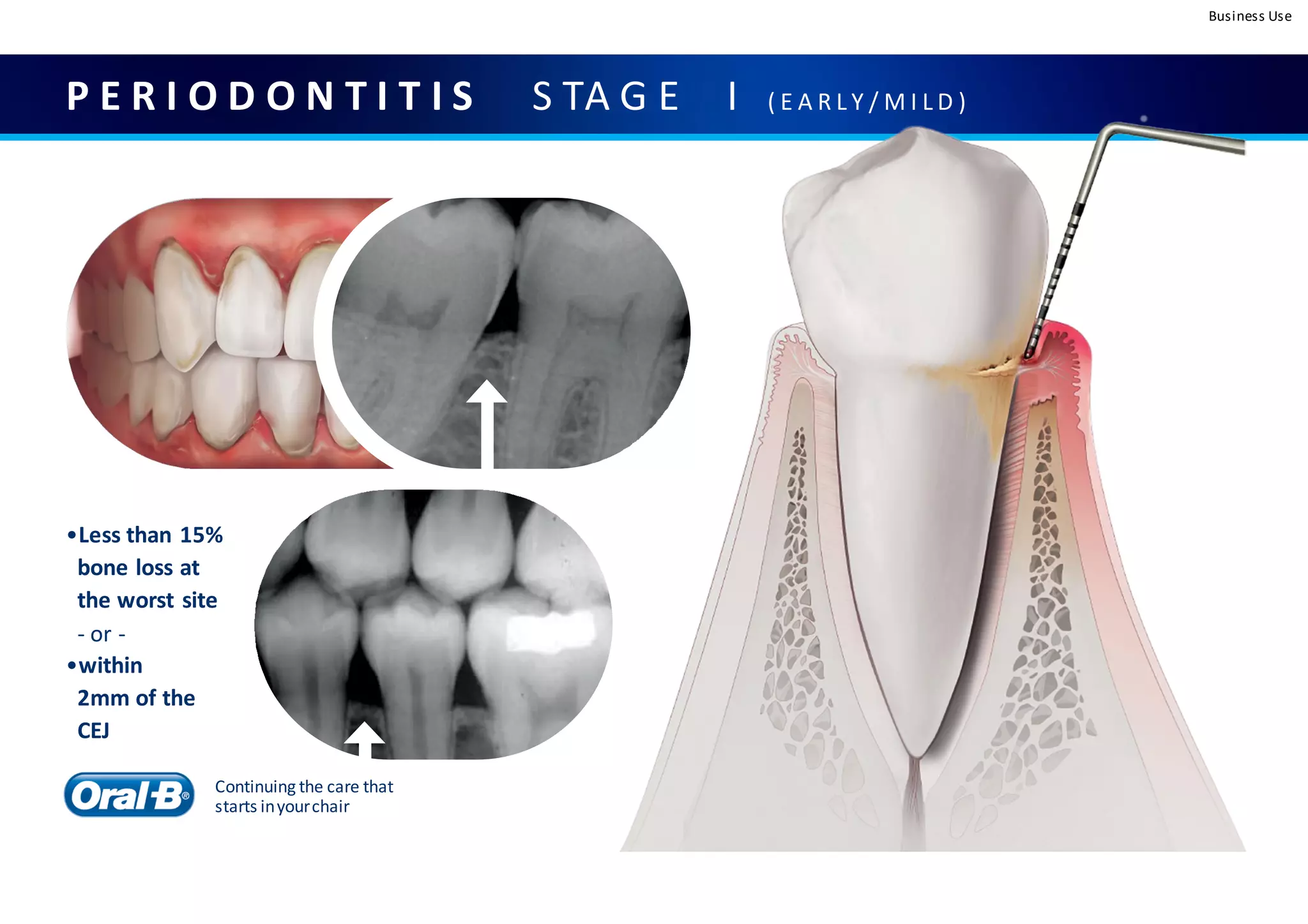 OralB_Patient_Guide_Flipchart final.pdf